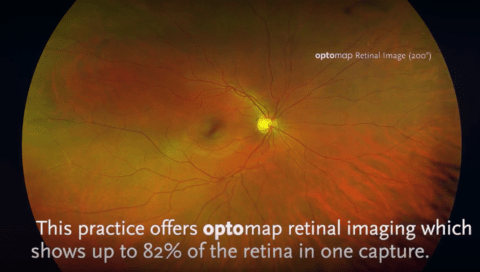 Optomap wide field eye scan