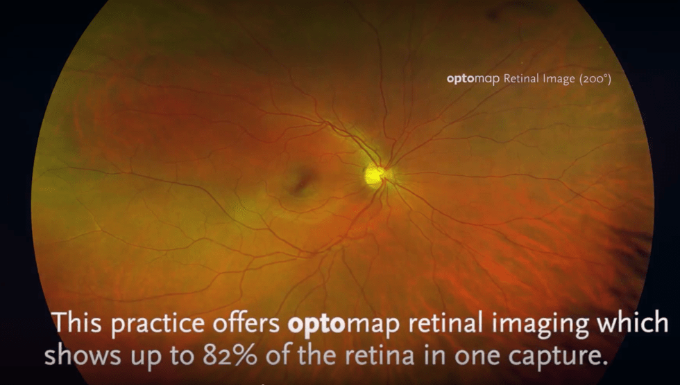Optomap wide field eye scan